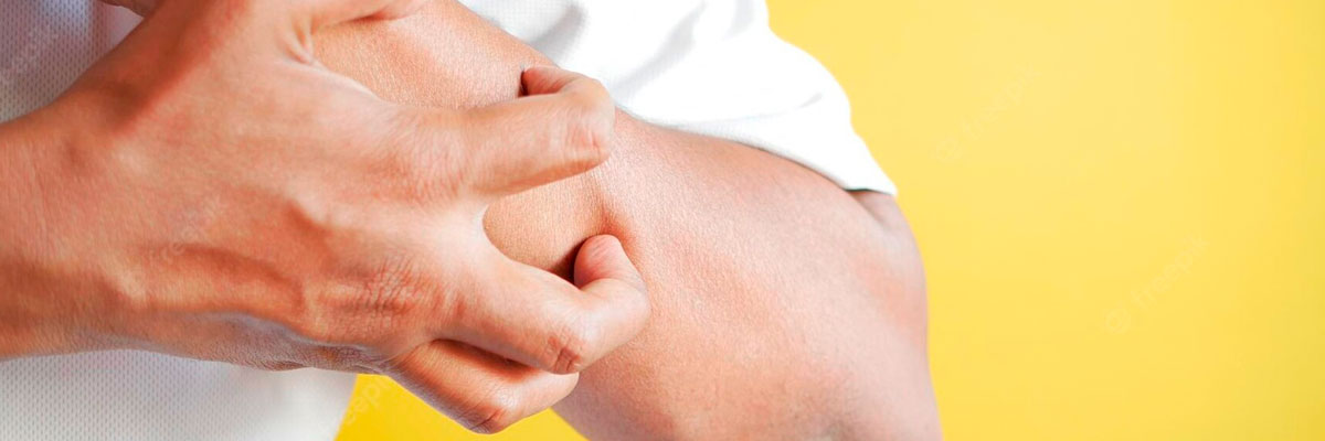 Central Médica Insular Canaria - Hablemos de la tiña, una infección ...